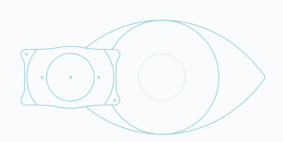 EVO ICL | Ophthalmology Associates